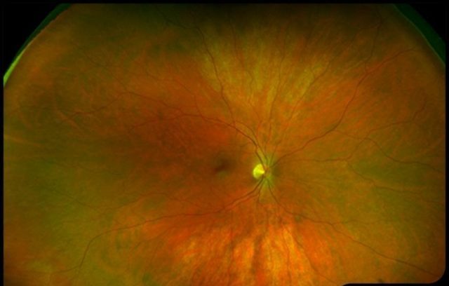 Our Technology - Focal Point Comprehensive Vision Care