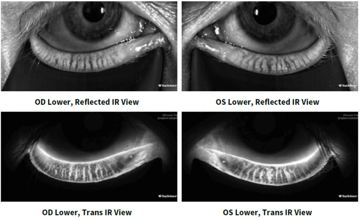 Adult and Senior Comprehensive Eye Exam Morden - Focal Point ...